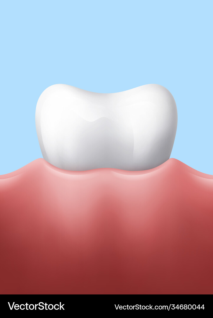 Tooth in gums Royalty Free Vector Image - VectorStock