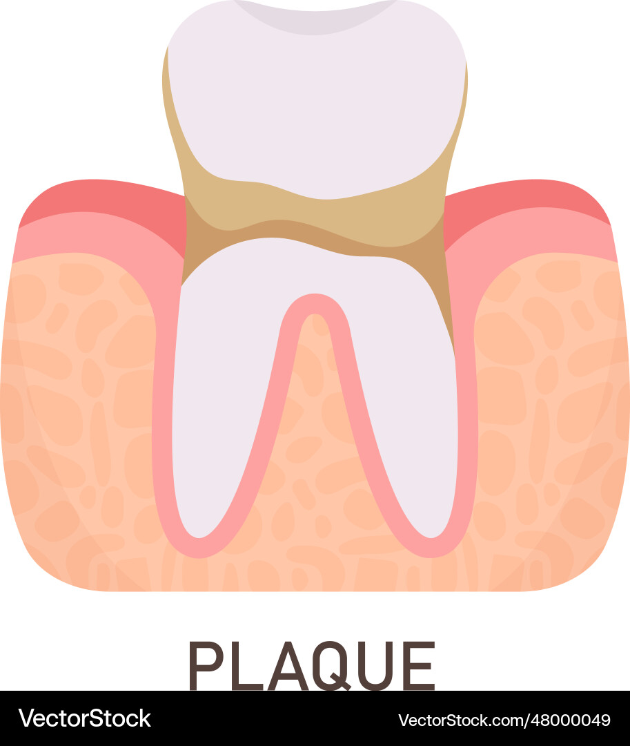 Plaque tooth problem Royalty Free Vector Image