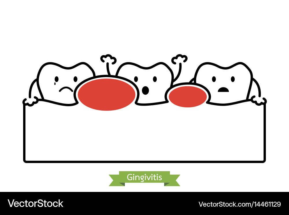 Gingivitis - cartoon outline style Royalty Free Vector Image