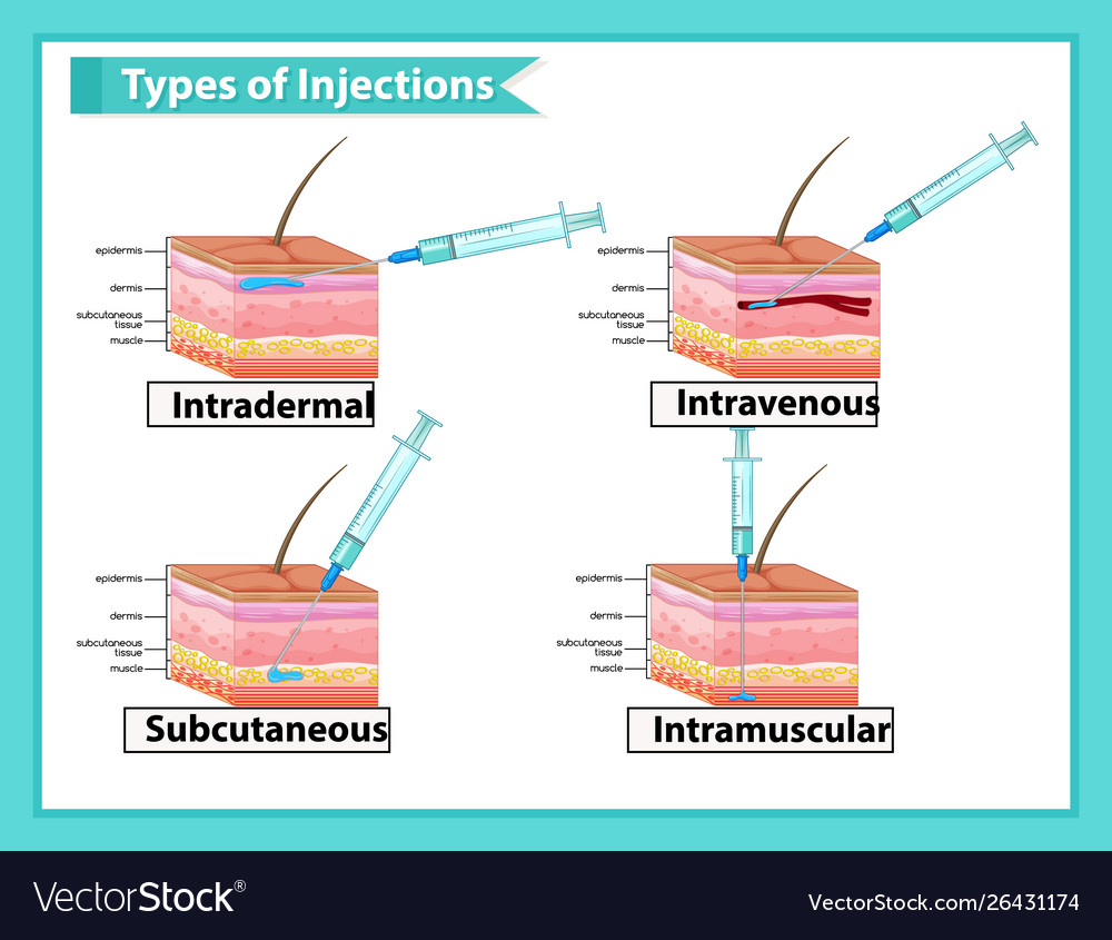 Different Types Of Injections Goimages Today Vrogue co