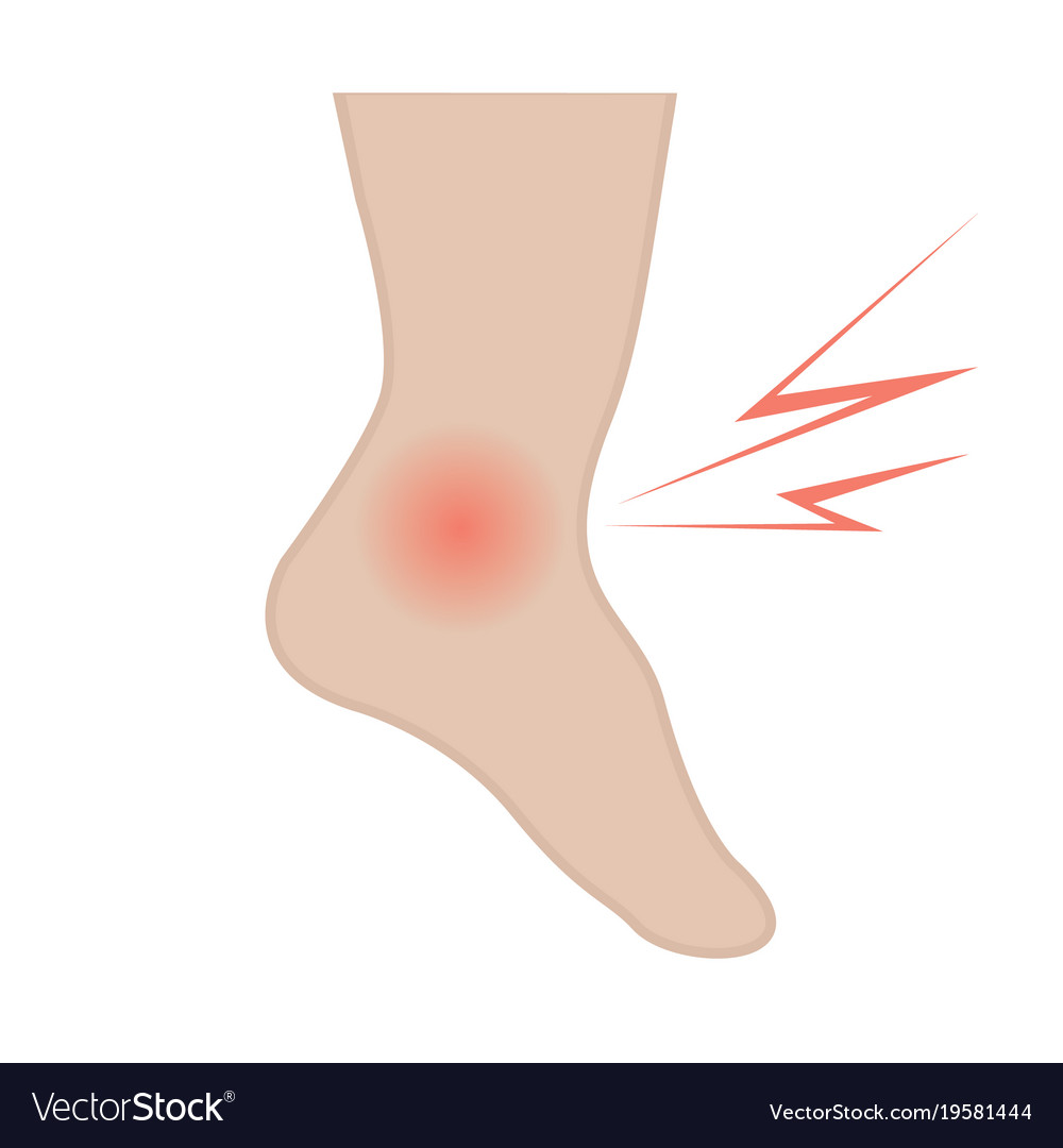 Swelling of the feet and ankles Royalty Free Vector Image