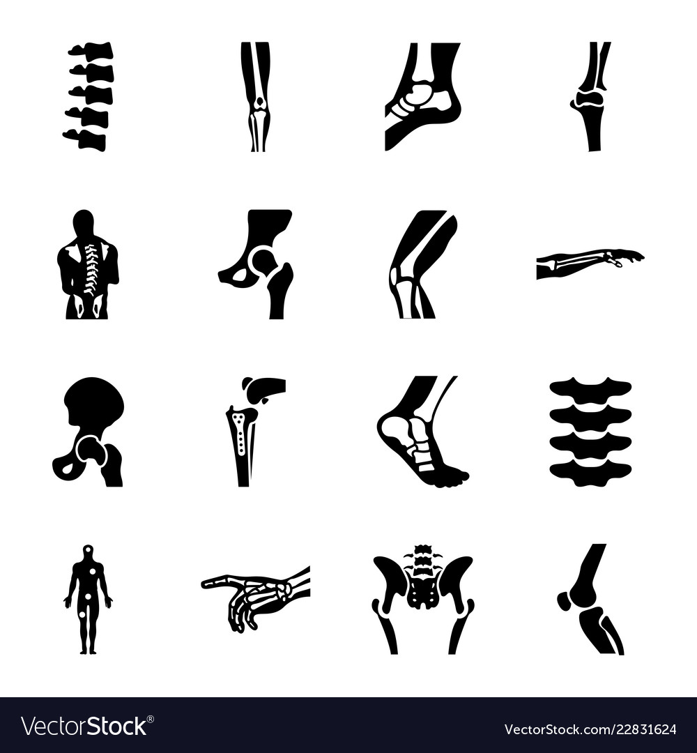 Orthopedic solid set Royalty Free Vector Image