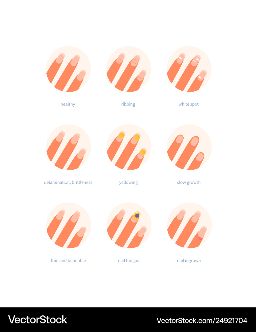 Nails problems Royalty Free Vector Image - VectorStock