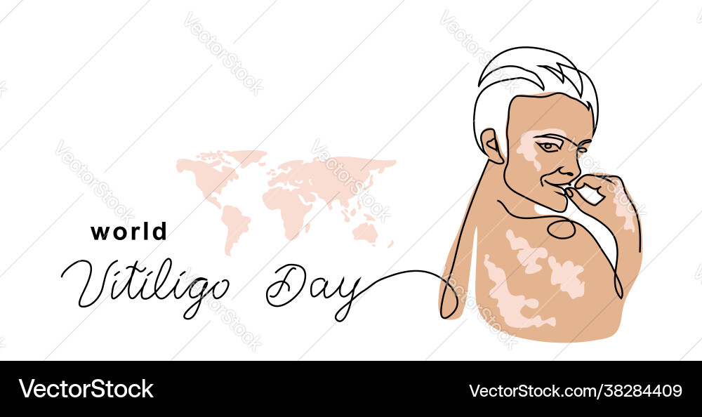 Vitiligo skin simple banner poster Royalty Free Vector Image