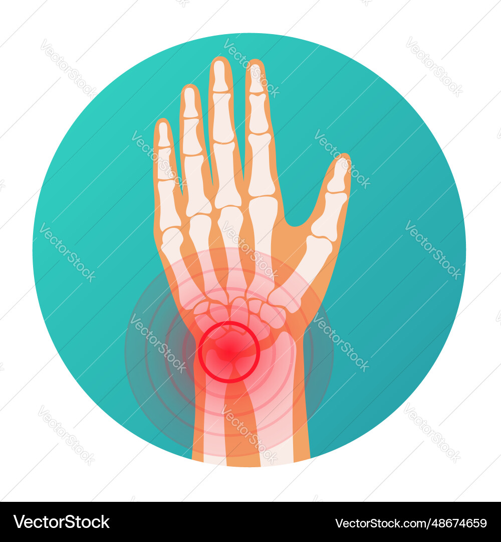 Red circle pain localization in human hand wrist Vector Image