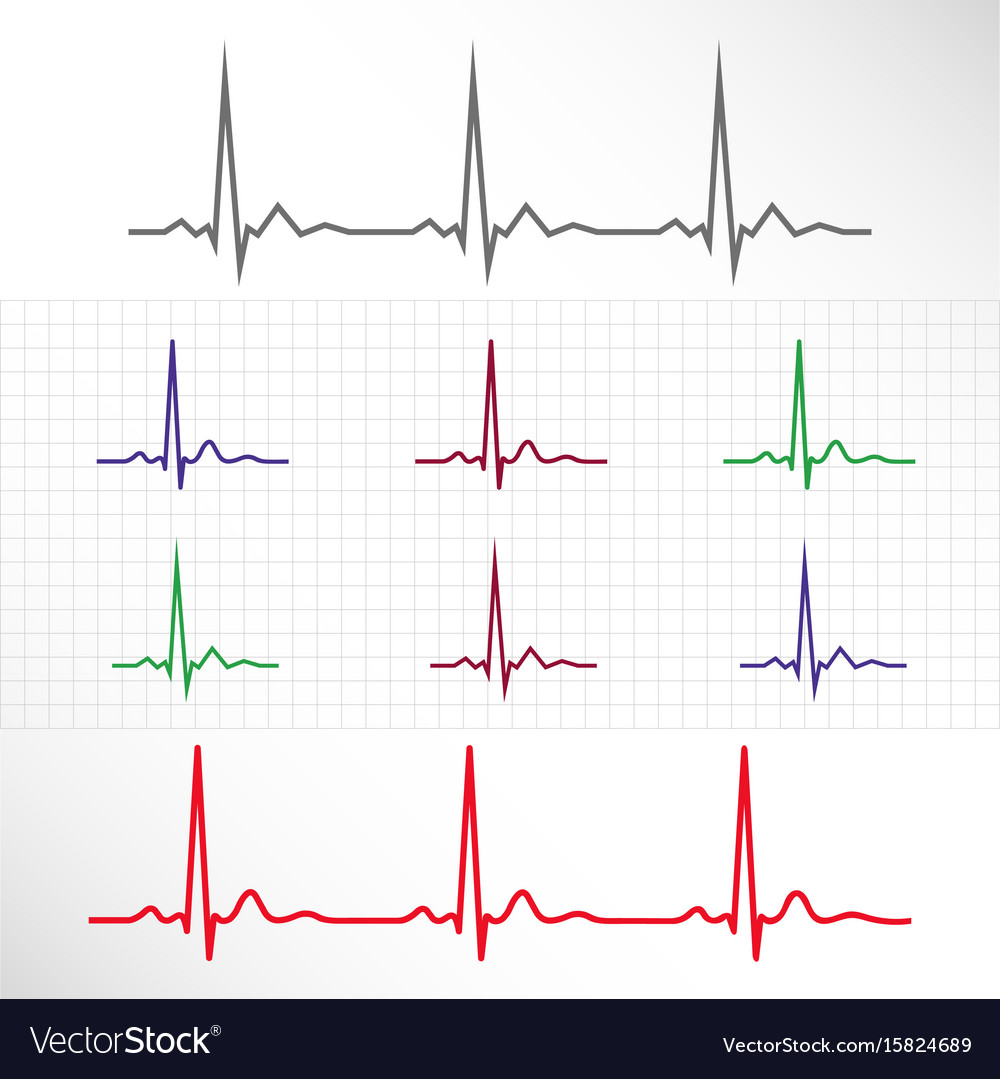 Normal Ecg