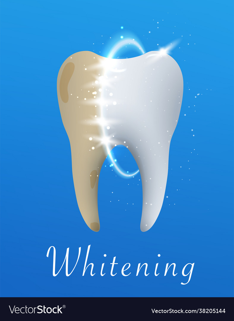 Tooth whitening Royalty Free Vector Image - VectorStock