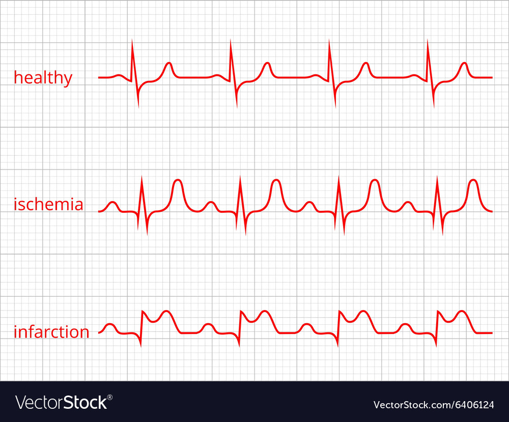 Heart Cardiogram Charts Set Healthy Heart Vector Image