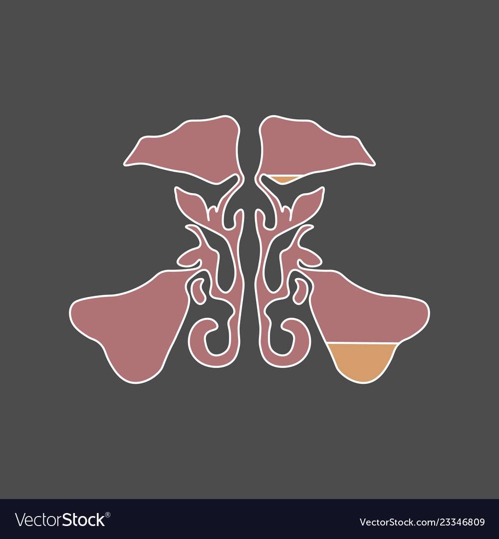 Flat Style Maxillary Sinus Sinusitis Royalty Free Vector