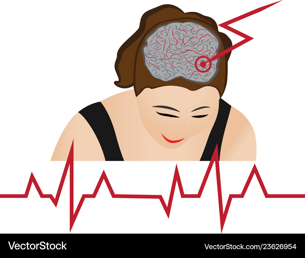 Stroke develop in human brains Royalty Free Vector Image