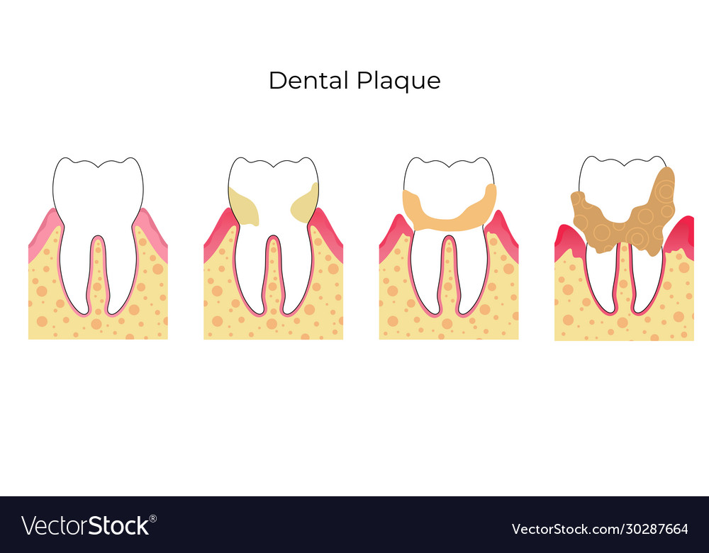 Isolated tooth Royalty Free Vector Image - VectorStock