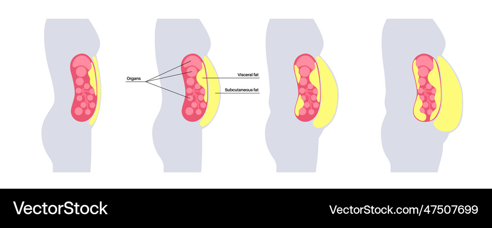 Visceral fat diagram Royalty Free Vector Image