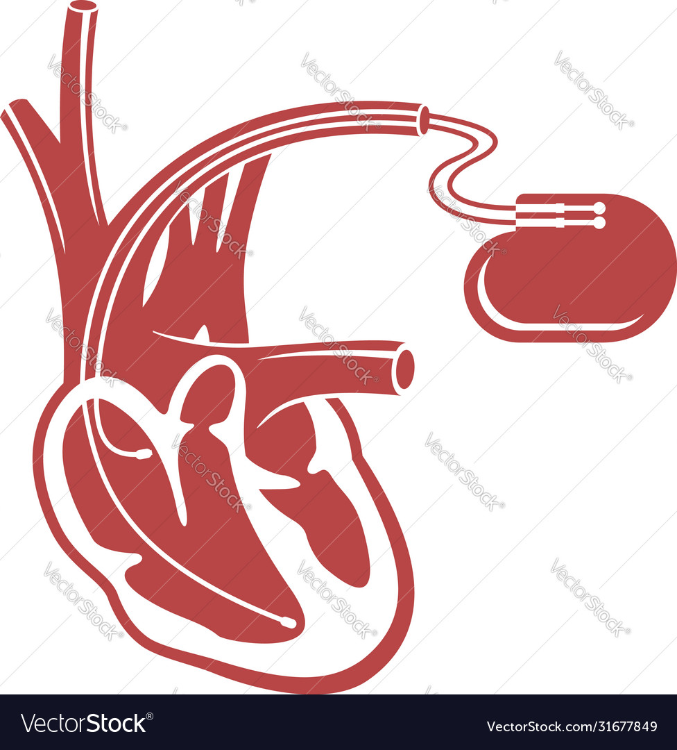 Pacemaker cardio stimulator flat icon Royalty Free Vector