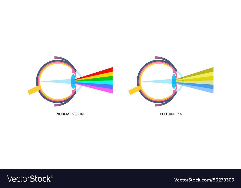 Protanomaly and protanopia Royalty Free Vector Image