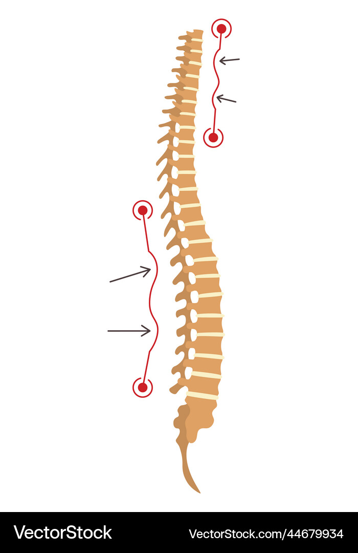 Spinal deformity symbol of spine curvatures Vector Image
