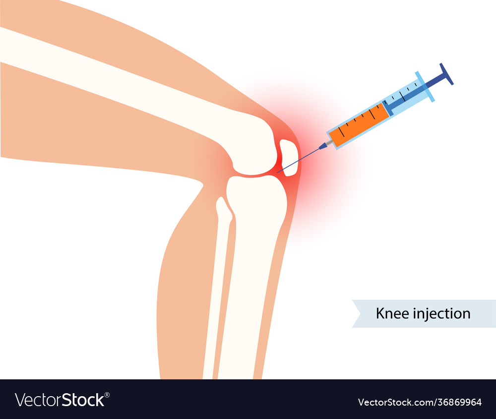 Knee injection concept Royalty Free Vector Image