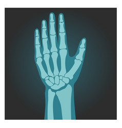 X-ray hand Royalty Free Vector Image - VectorStock