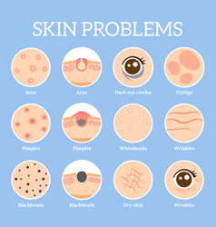 Skin problems ages wrinkles problem face skin Vector Image
