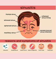 Sinusitis infographics Royalty Free Vector Image