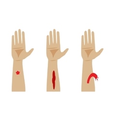 Types bleeding Royalty Free Vector Image - VectorStock